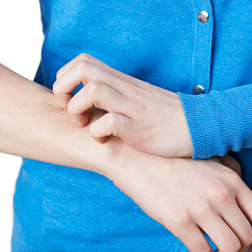 Top Tips from a Dermatologist for Treating Dry Skin | Schweiger ...