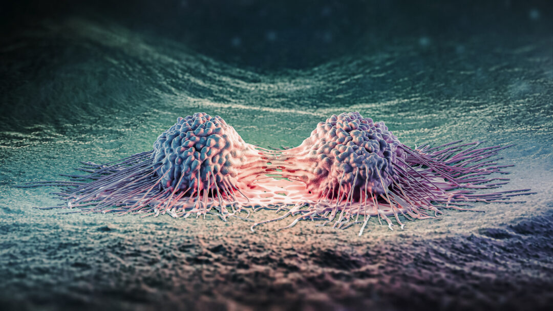 What Is Squamous Cell Carcinoma? Signs, Risks, and What to Do